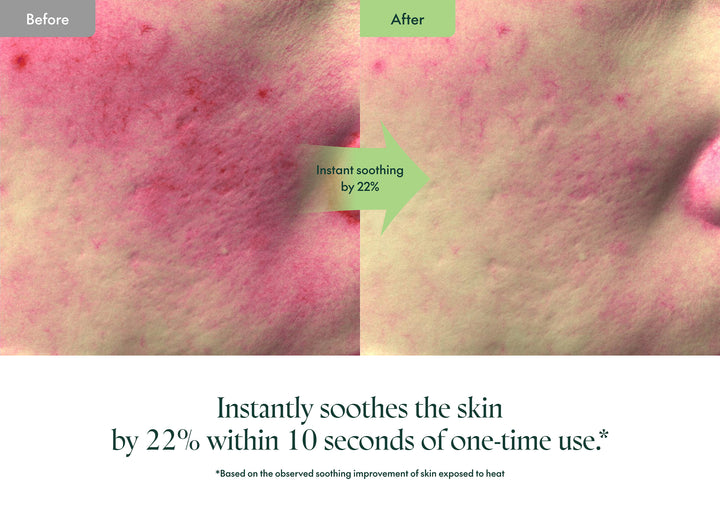 Purito SEOUL Wonder Releaf Centella Toner Unscented Mini (30ml ...